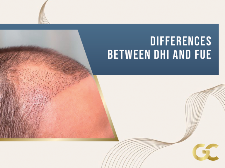 What are the FUE technique and DHI method? - Acıbadem Best Hair ...