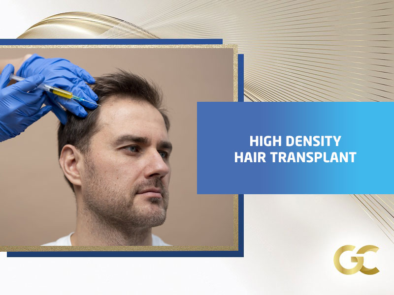 High Density Hair Transplant Ac badem Best Hair Transplant Turkey High Density Hair Transplant Ac badem Best Hair Transplant Turkey